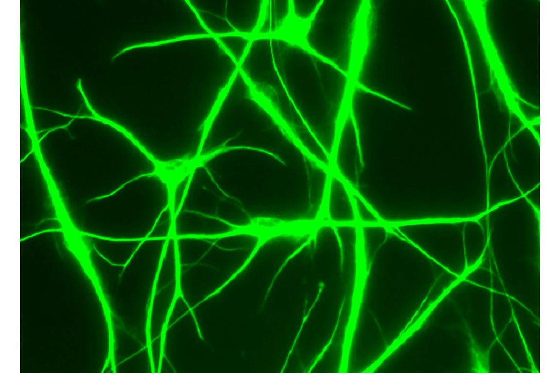 Differences in human, mouse brain cells have important implications for ...