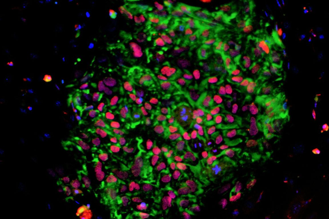 Researchers awarded $4.7 million to study genomic variation in stem ...