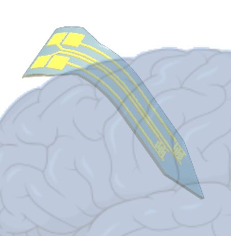 UCLA-developed soft brain probe could be a boon for depression research ...