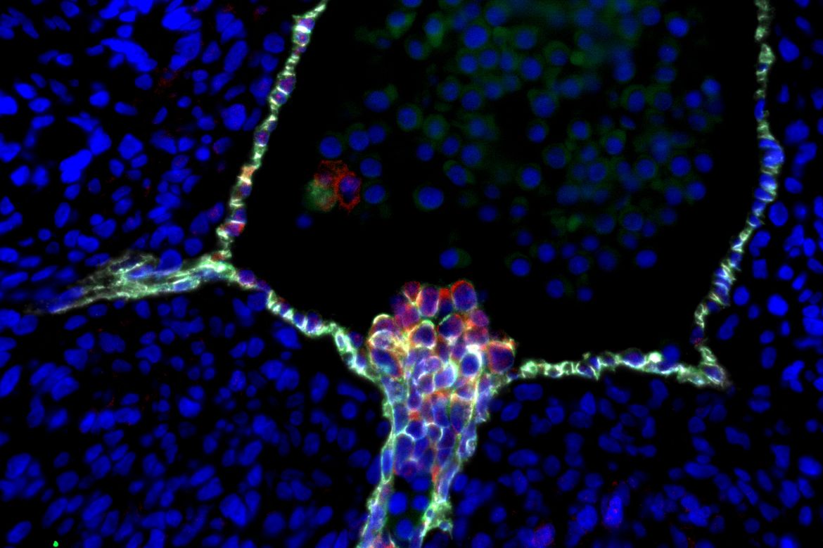 UCLA-led team creates first comprehensive map of human blood stem cell ...