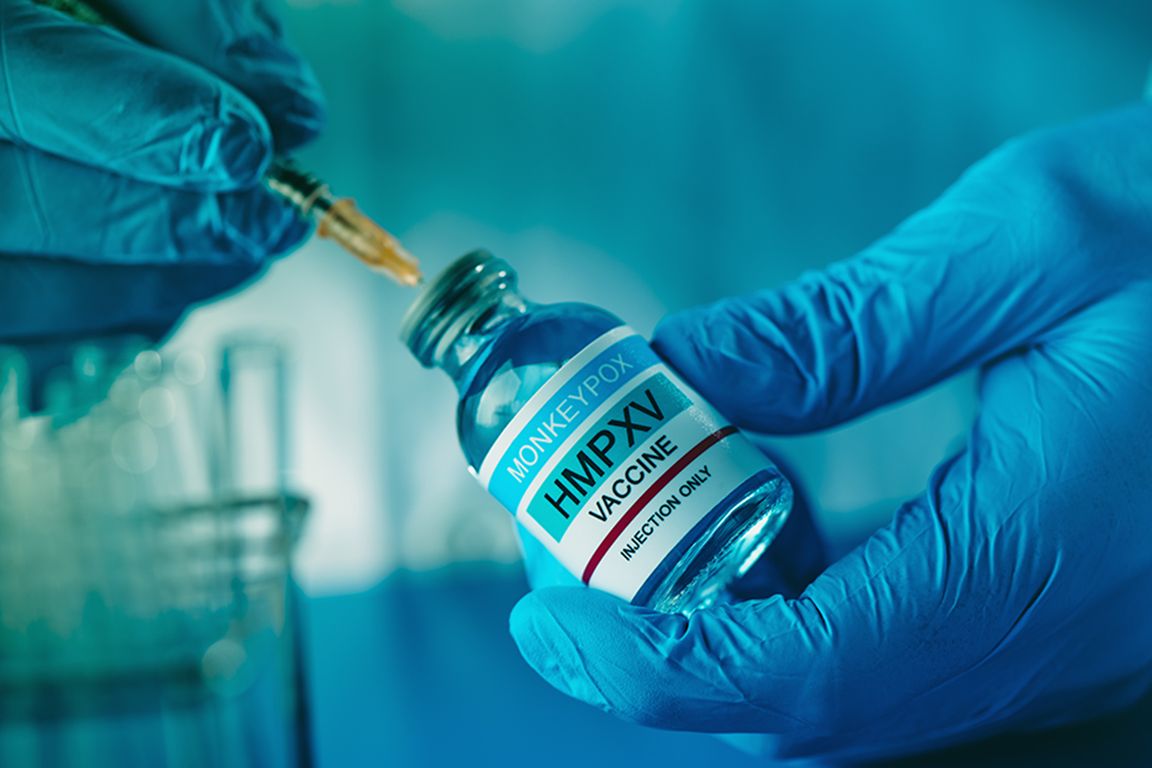 UCLA research helps guide public health response to ongoing monkeypox ...