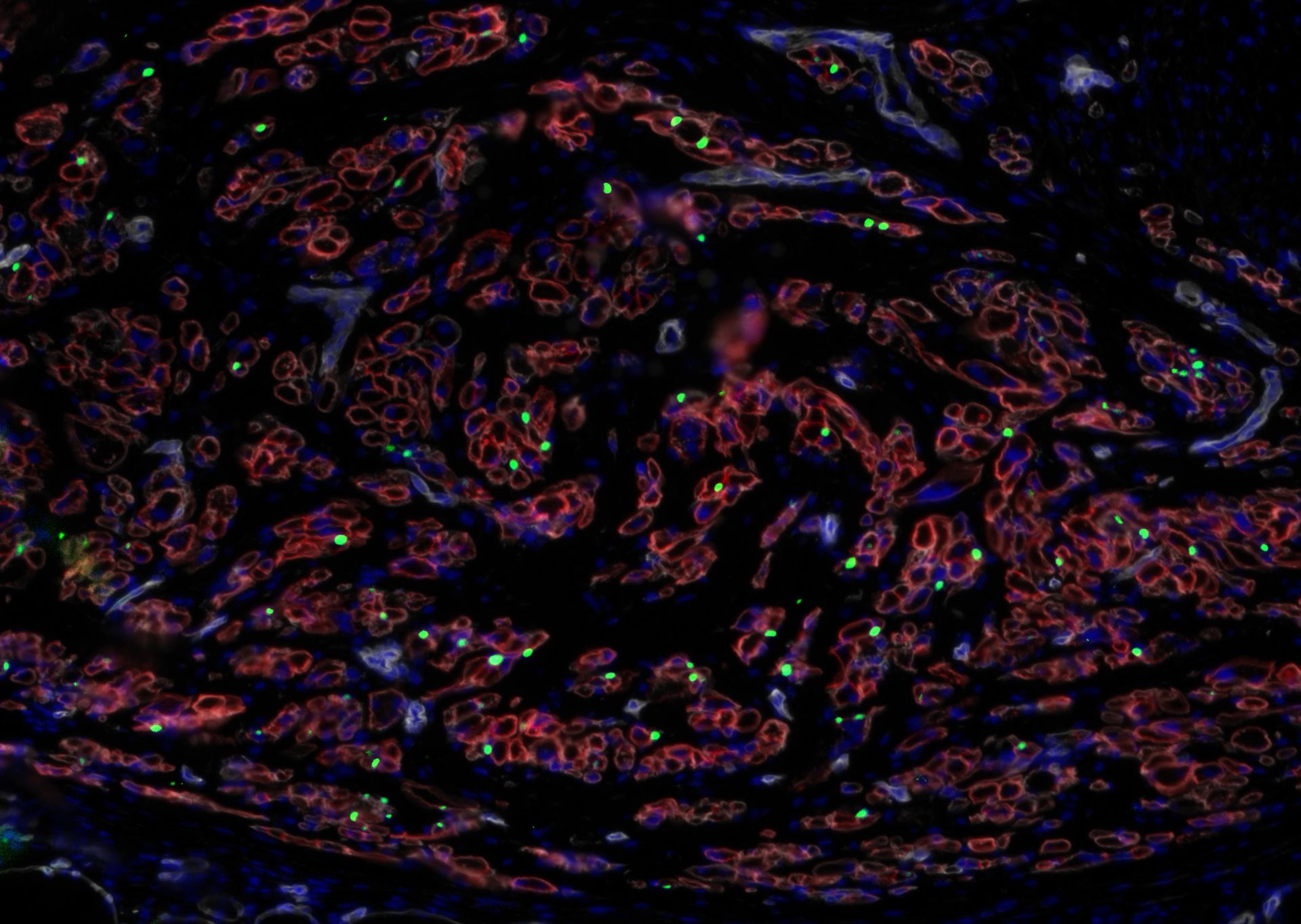 Photo | Stem cell research image showing muscle progenitor cells and ...