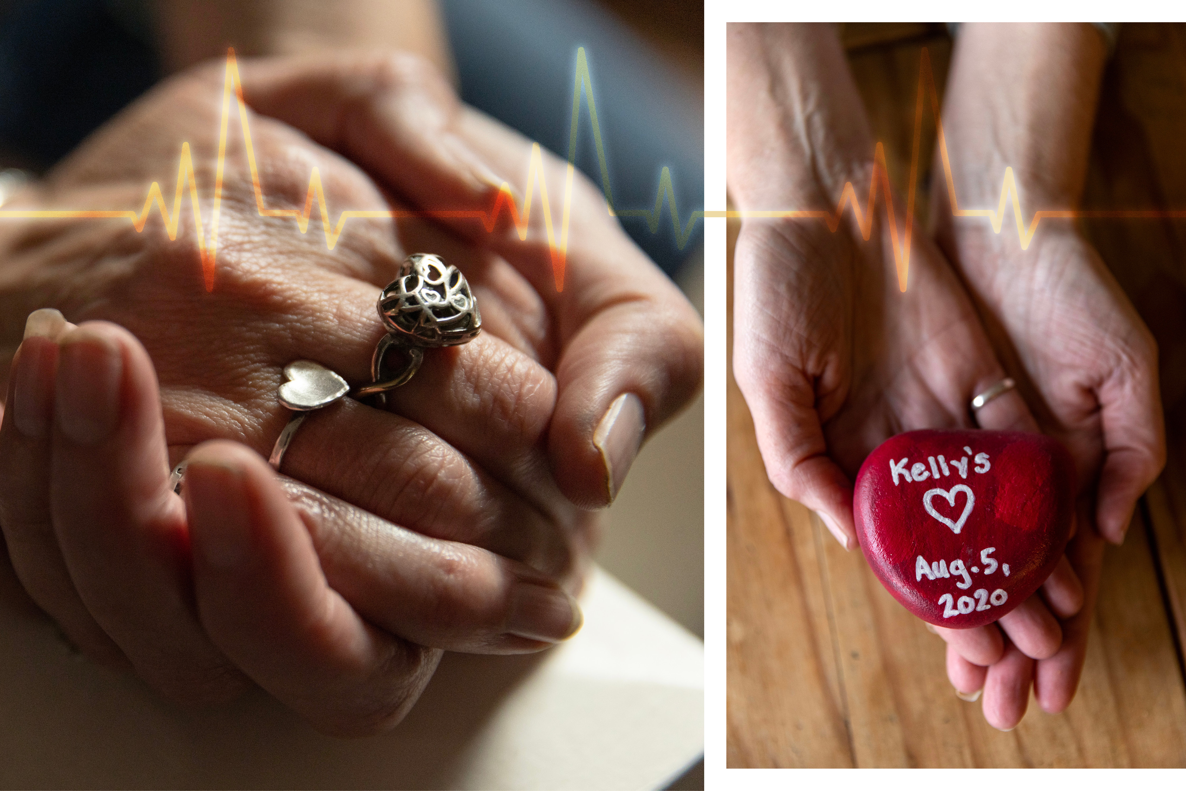 The Gift of Lives | UCLA