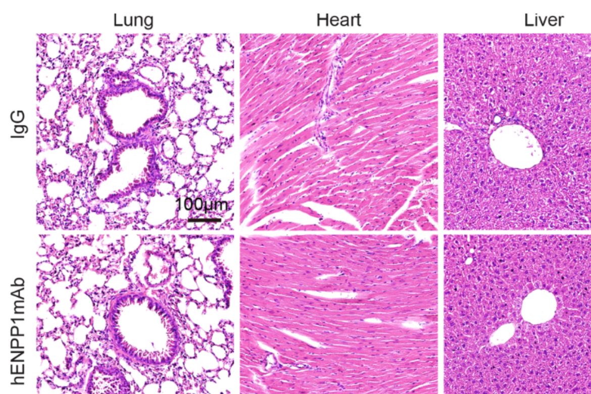 Photo | Deb ENPP1 Feature Image | UCLA