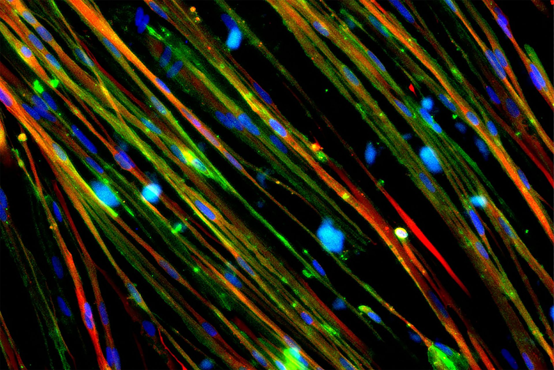 Photo | Colorful strands showing restoration of dystrophin (stained ...