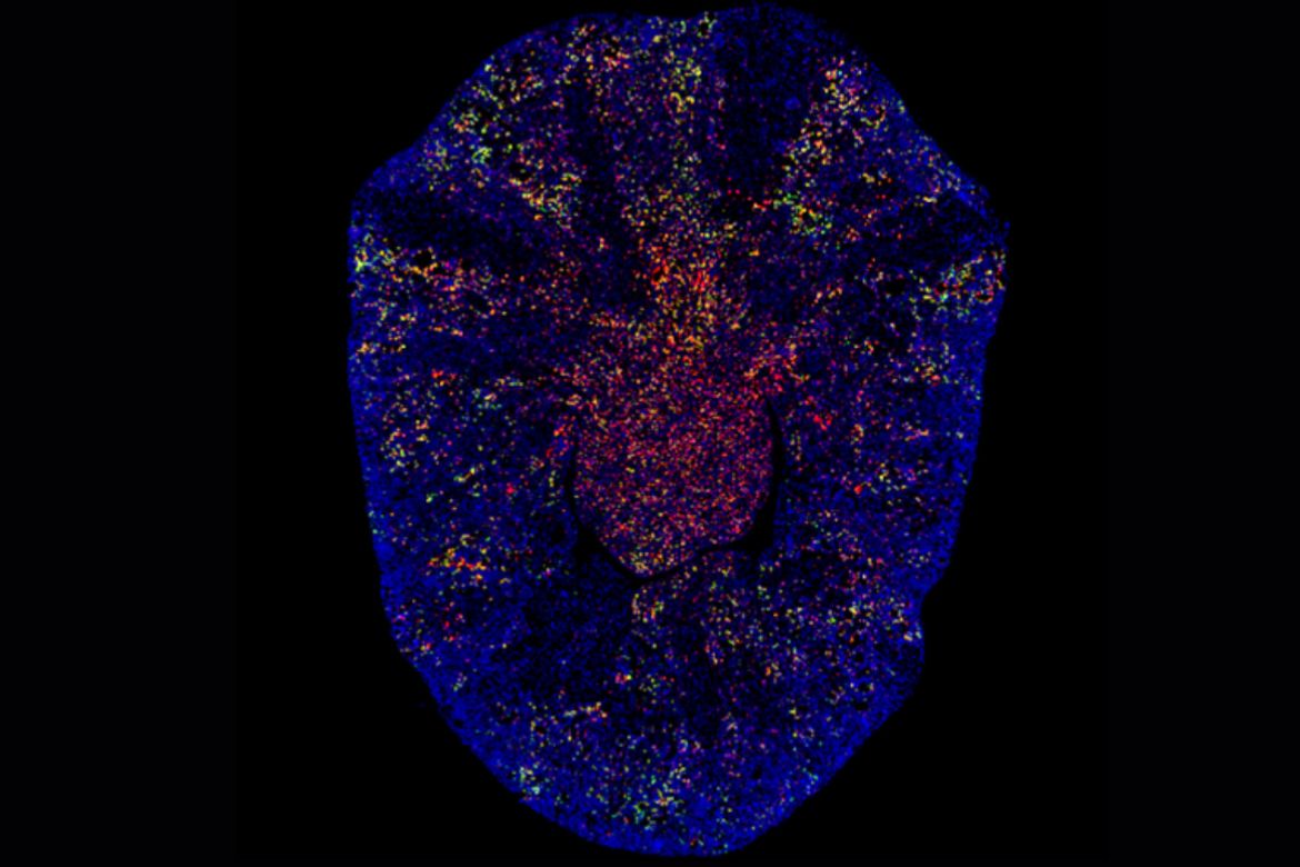 Precision medicine approach could prevent kidney failure | UCLA