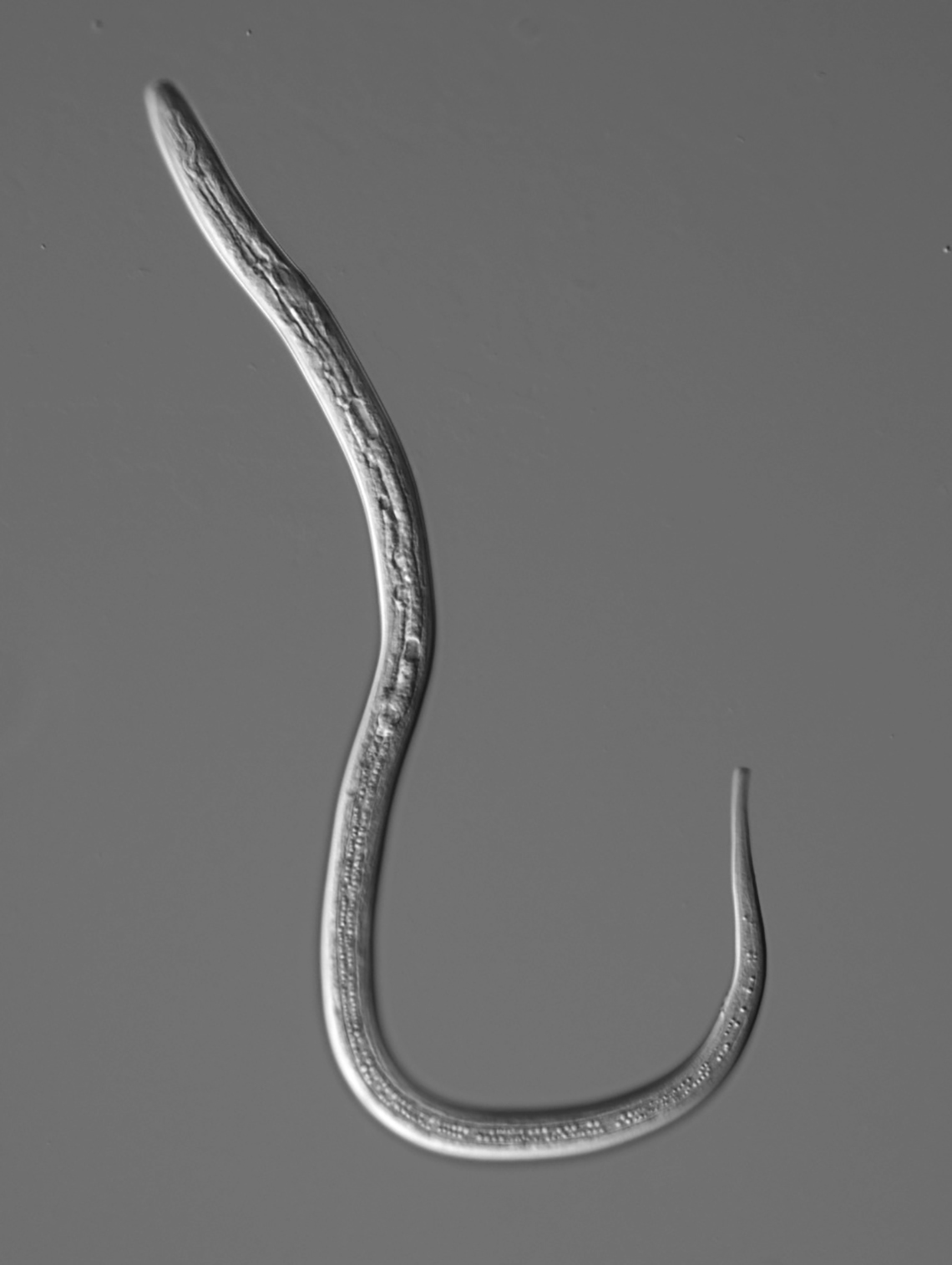 Researchers are inching closer to stopping parasitic worms from getting ...