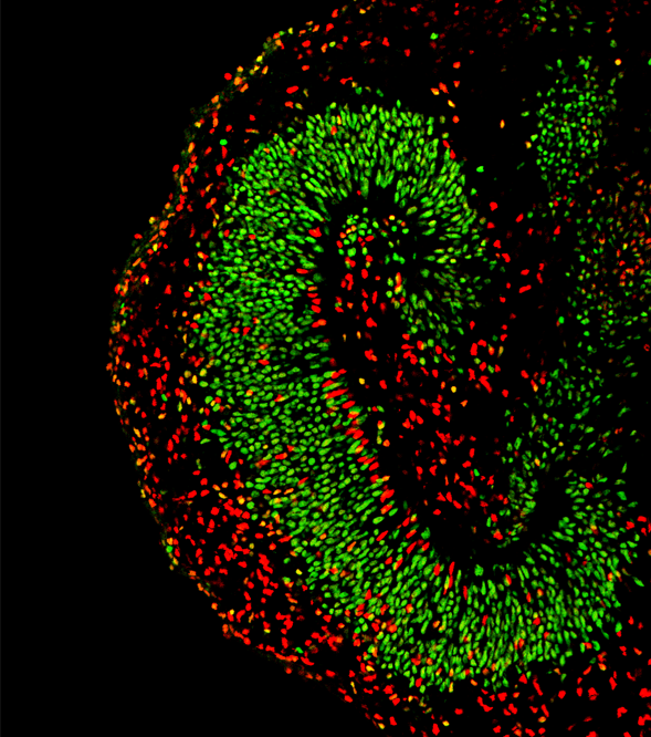 UCLA researchers find how epilepsy genes disrupt different brain regions using stem cell models ...