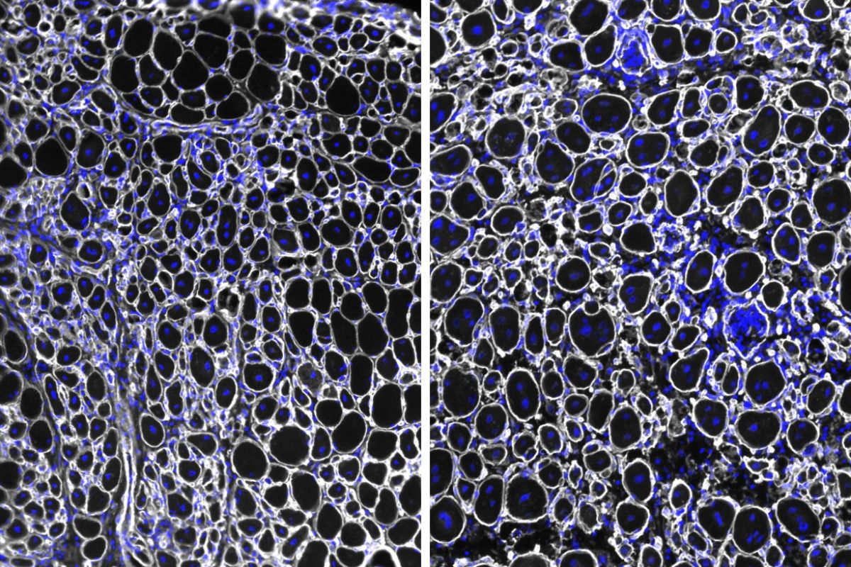 Photo | Two side-by-side microscope images of muscle tissue from aged ...