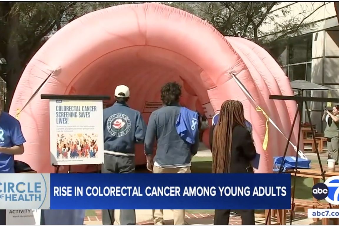 UCLA doctors hope larger-than-life display gets people talking about ...