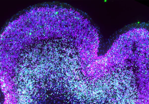 Can dopamine bend time to shape memory? | UCLA