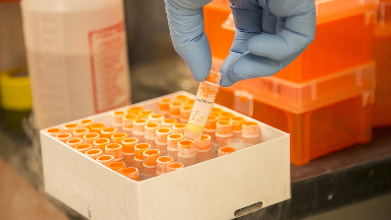 Unlocking the secrets of disease progression | UNM UCAM Newsroom