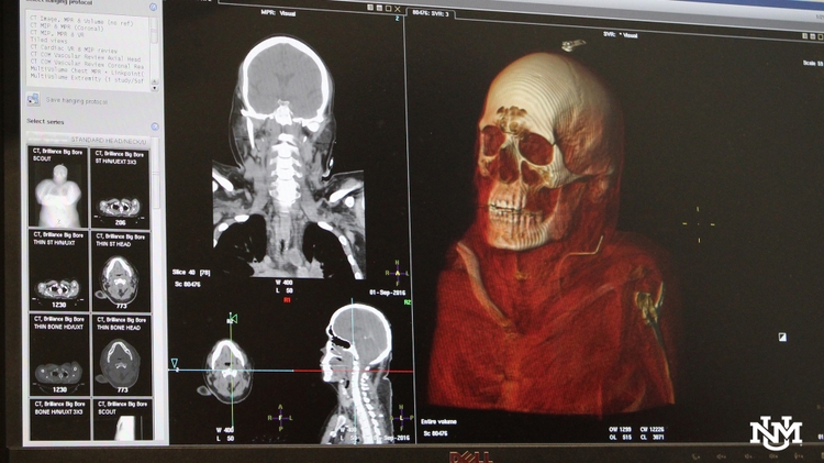 Skull scan |UNM Newsroom