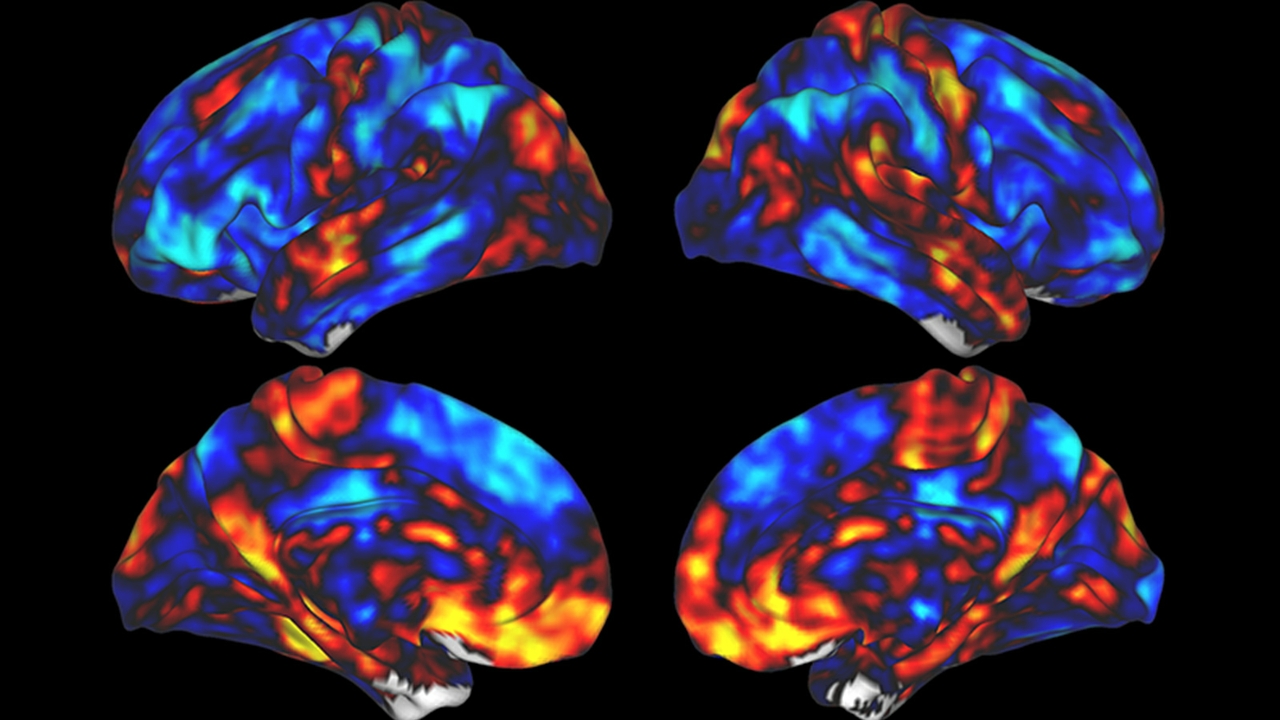 UNM researcher awarded $2 million grant to use brain stimulation to ...