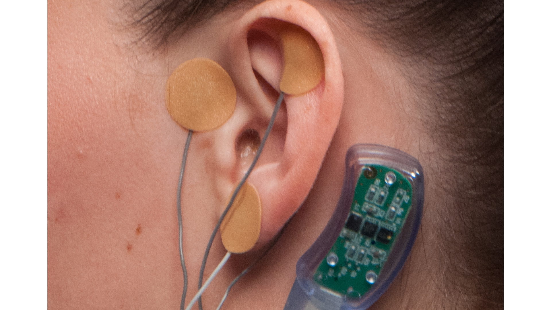 NewMediaWire | Innovative BRIDGE Device Awarded Prize in Ohio Opioid Fight