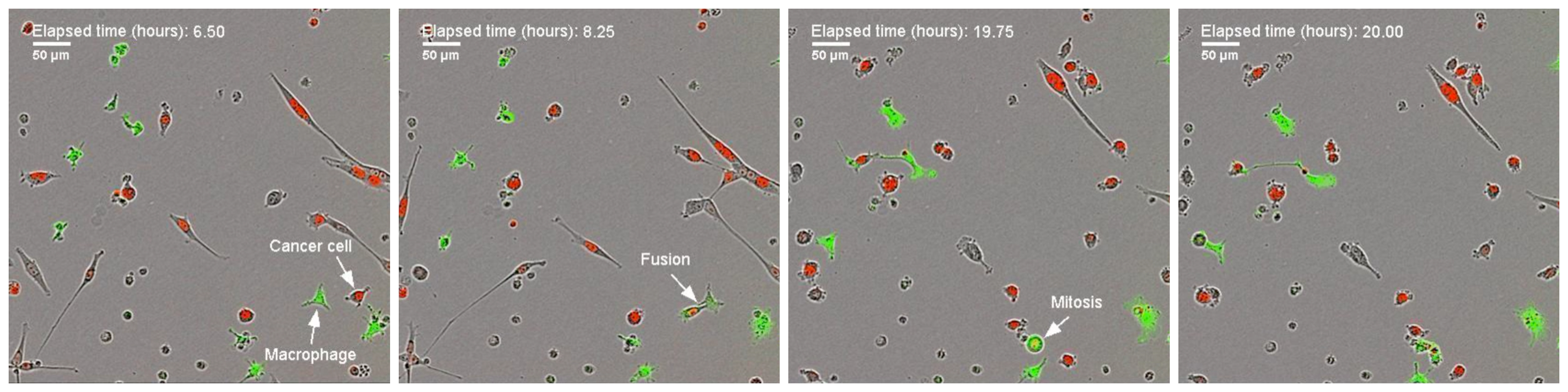 Tumor cells fuse with immune cells and become more aggressive | OHSU News