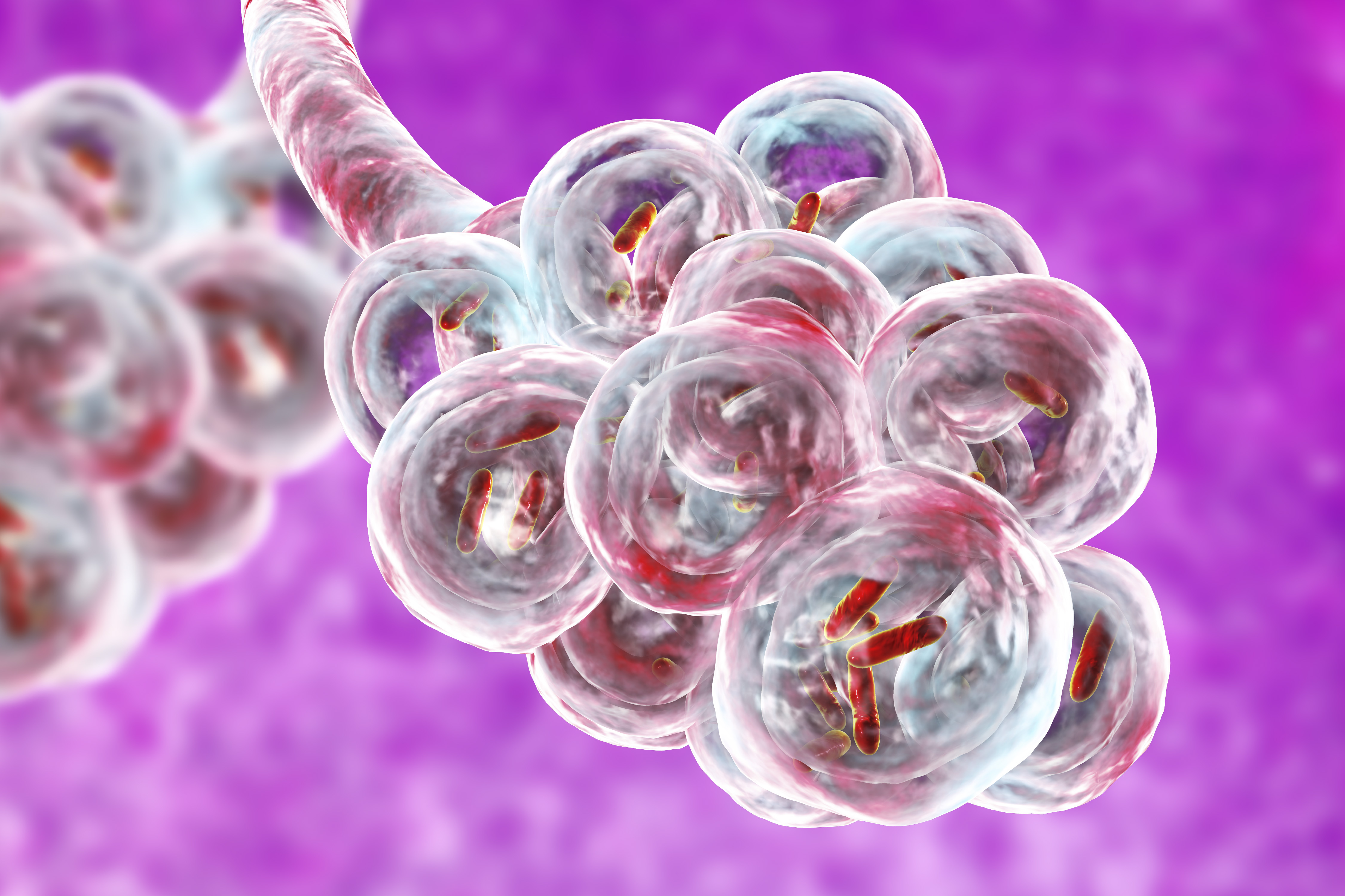 Pneumonia prevention: OHSU to test specialized breathing tubes | OHSU News