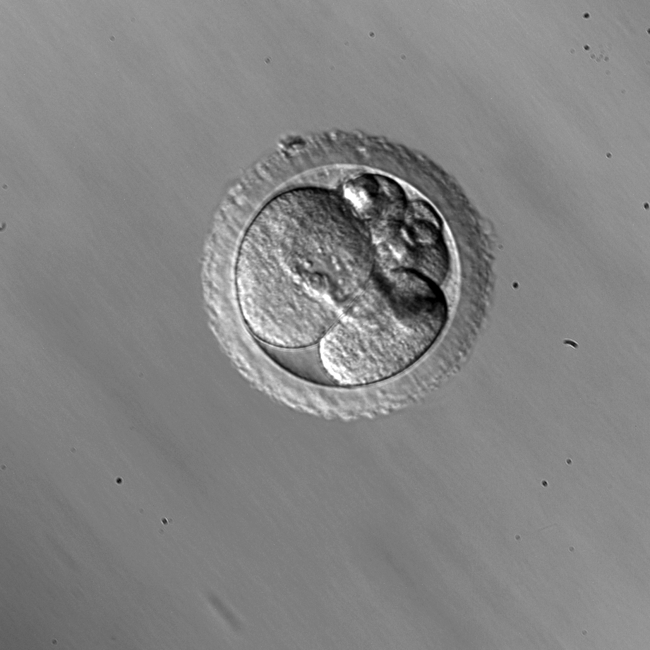 Are mosaic embryos the ‘dark horse’ of IVF? | OHSU News