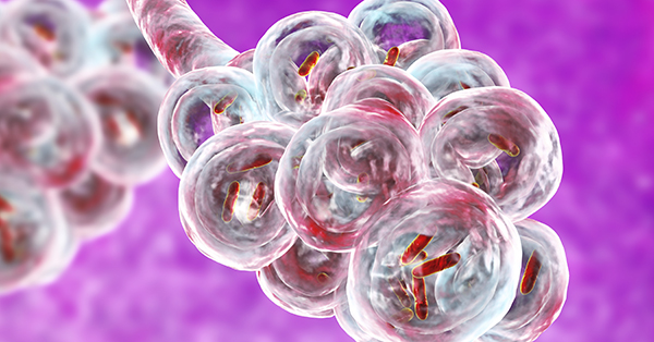 Pneumonia prevention: OHSU to test specialized breathing tubes | OHSU News