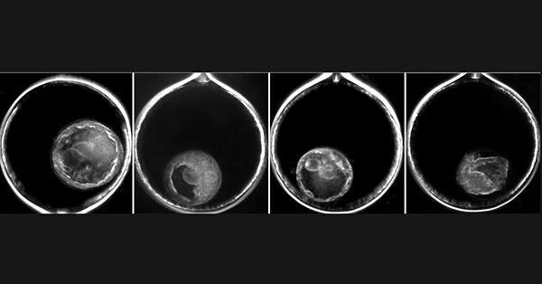 Are mosaic embryos the ‘dark horse’ of IVF? | OHSU News