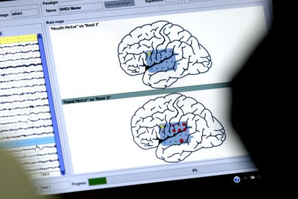 Patients awake, taking active role during brain surgery | OHSU News