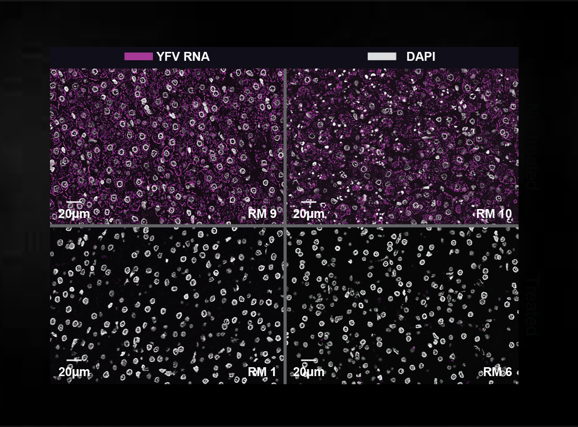 Lab-made antibodies offer potential cure for yellow fever | OHSU News