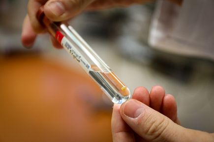 El clítoris, el órgano humano que produce placer, tiene más de 10,000 ...