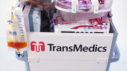 ‘Liver in a box’ helps save more lives, can improve transplant outcomes ...