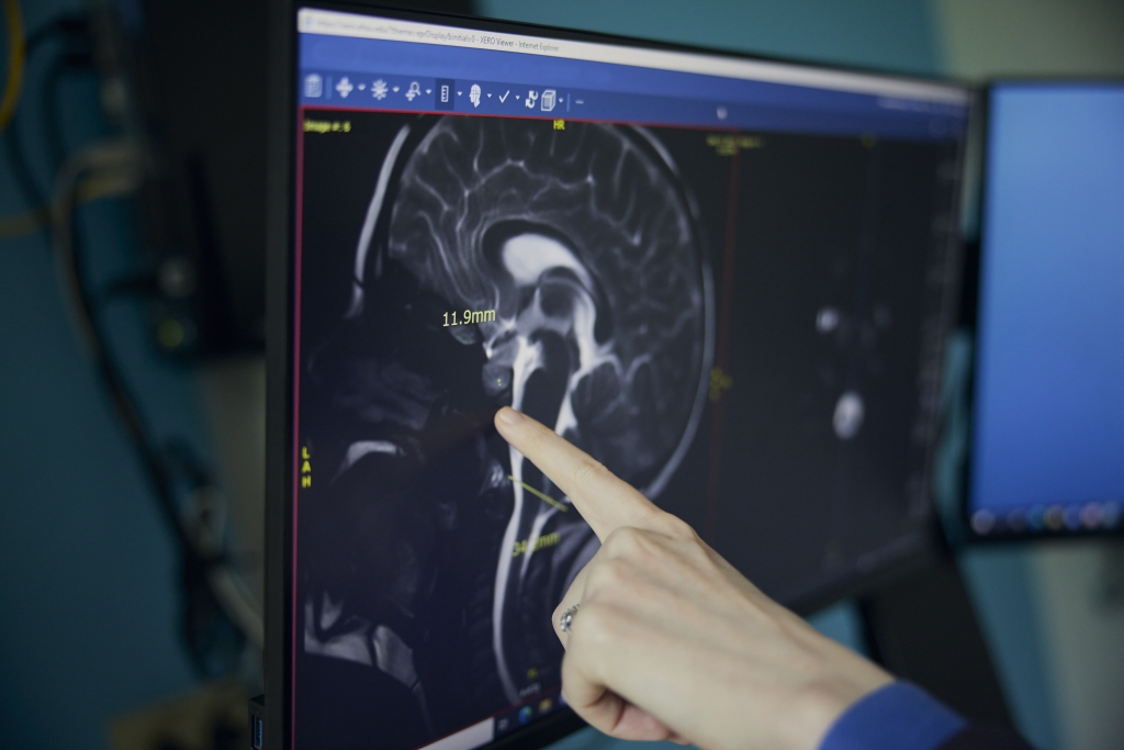 Doernbecher pediatrics - neurology |OHSU News