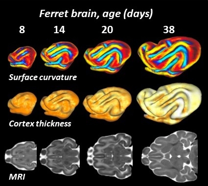 Advanced Imaging Research Center helps scientists make ground-breaking ...