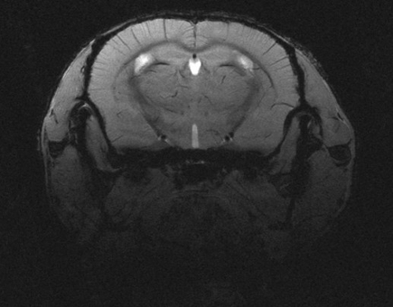 Advanced Imaging Research Center helps scientists make ground-breaking ...