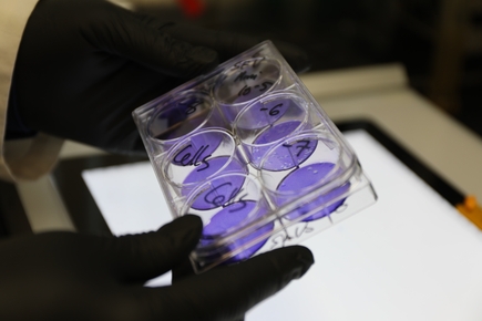 Review suggests ending adult boosters for tetanus, diphtheria | OHSU News