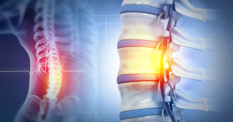Research Unveils New Spinal Injury Treatment Method | Mirage News
