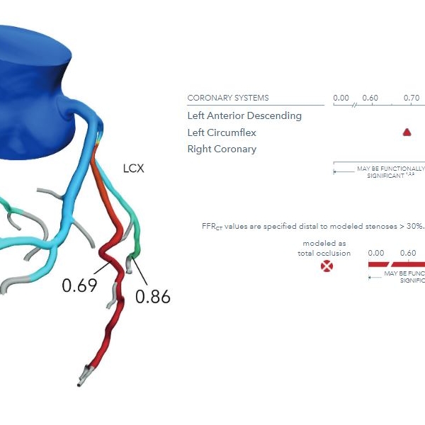 This procedure gives your AFib patients an alternative to blood ...