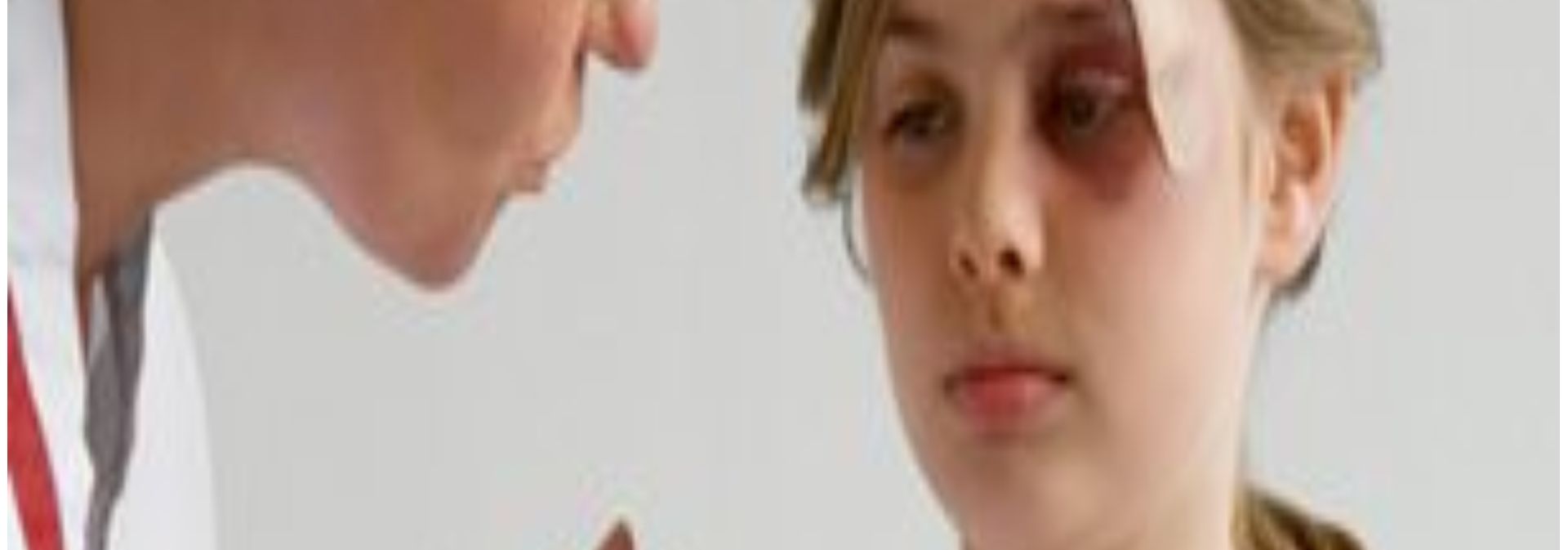 Play it Safe: Avoiding Common Eye Injuries | URMC Newsroom