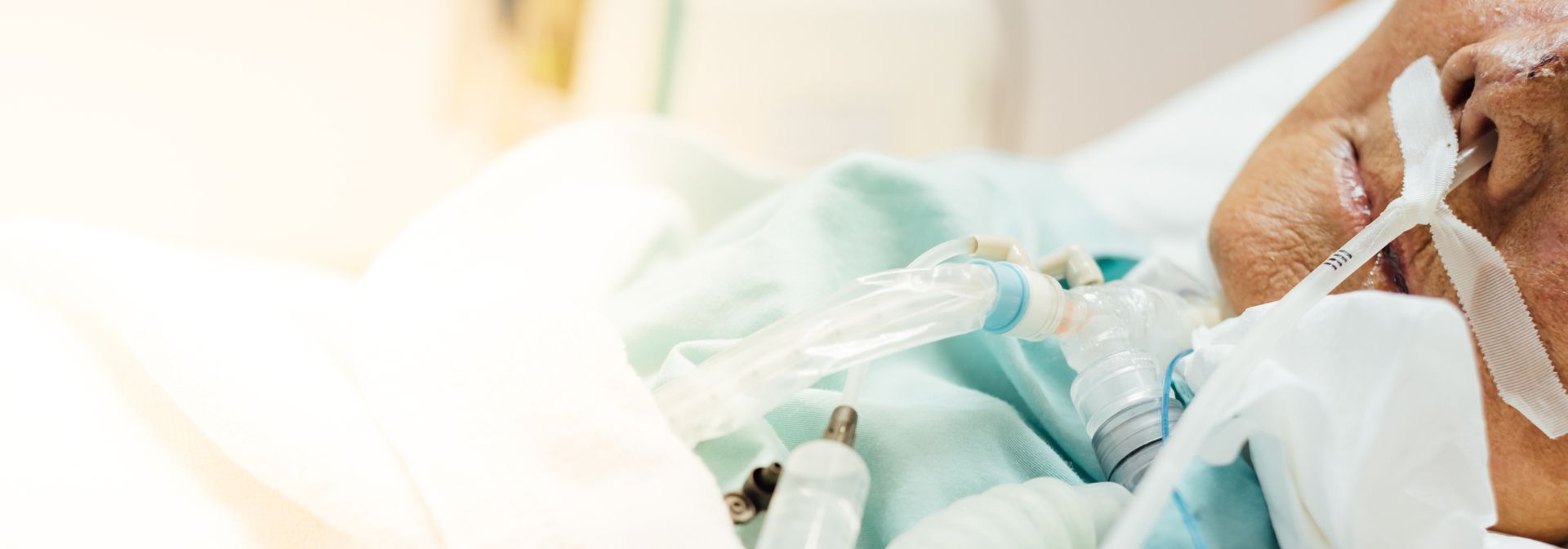 Low Tidal Volume Strategy: Why You Can’t “Set it and Forget It” | URMC ...