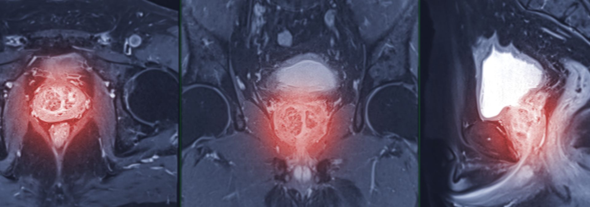 Interdisciplinary Approach Provides Best Possible Care for Patients ...