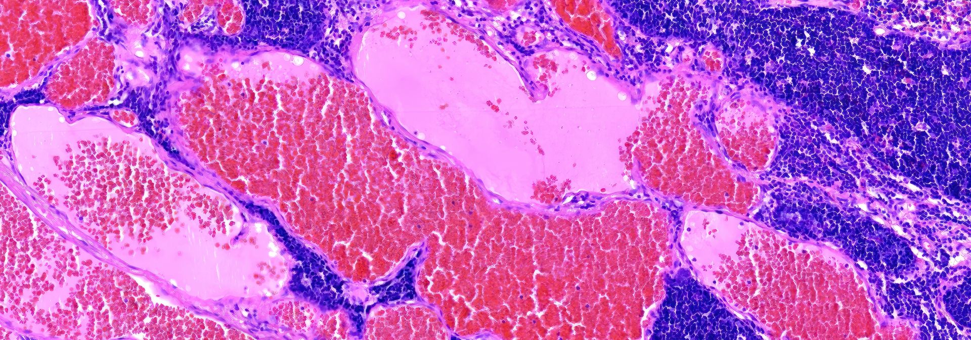 Christa Whitney-Miller Named Chair of Pathology and Laboratory Medicine ...