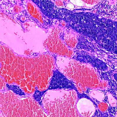 Bethany Lindsey Honored | URMC Newsroom