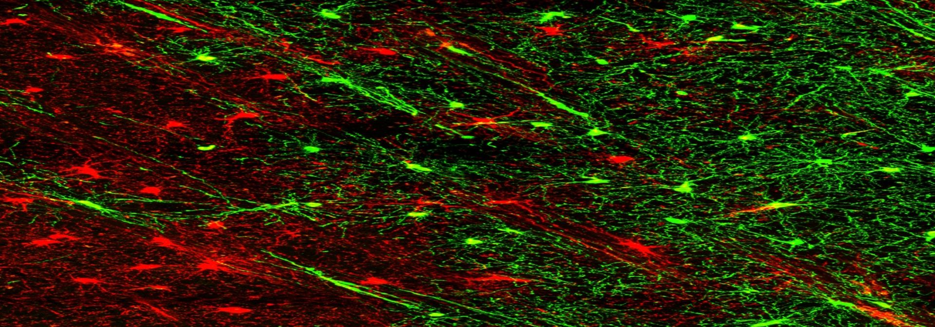 Trading Sickness for Health: Swapping Brain Cells Points to New ...