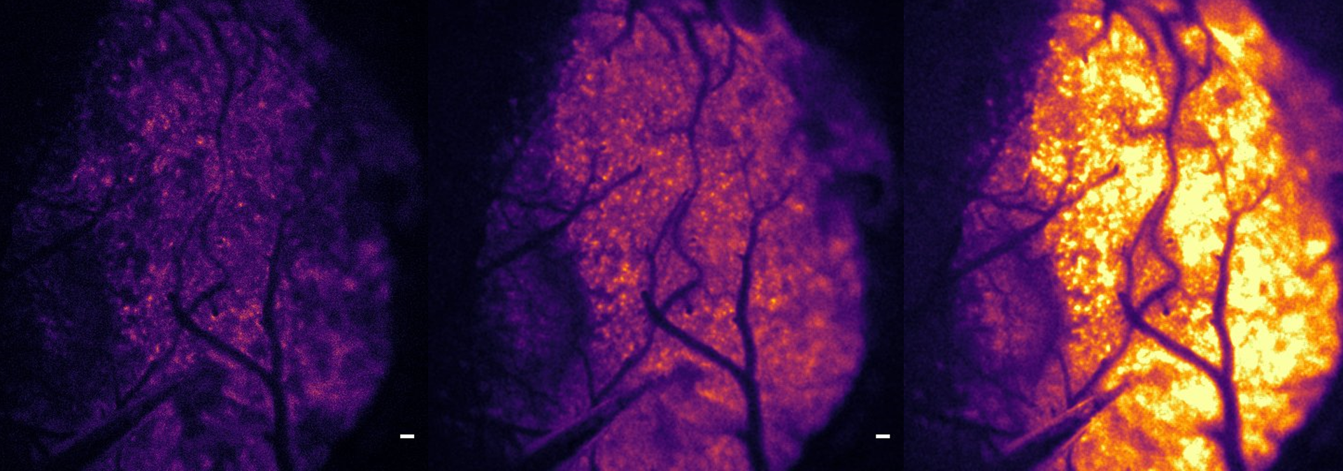 New Imaging Method Illuminates Oxygen's Journey in the Brain | URMC ...