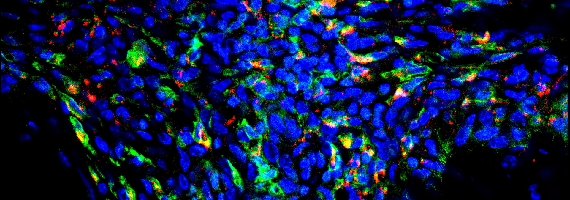 Researchers Find Intriguing New Tool for Tendon Healing: Nanoparticles ...