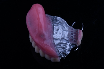 URMC Cancer and Dental Specialists Help Man Regain Function, Speech ...