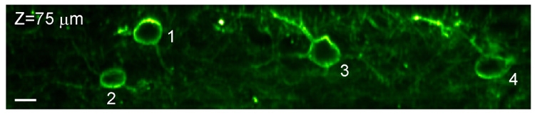 High-speed microscope captures fleeting brain signals | Berkeley