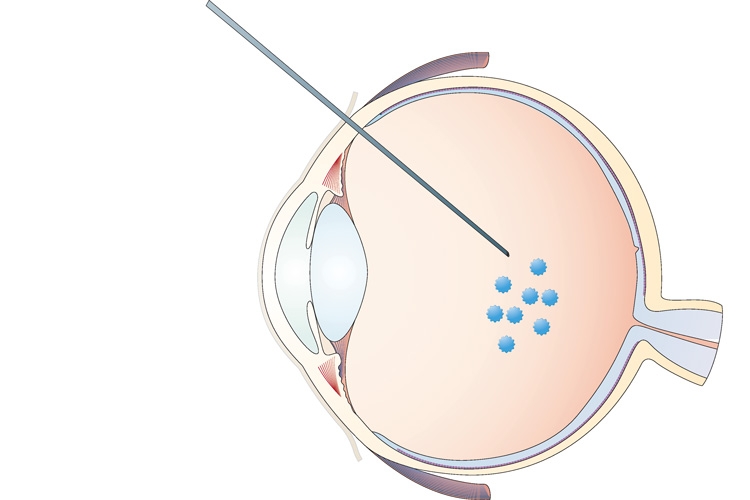 With single gene insertion, blind mice regain sight | Berkeley