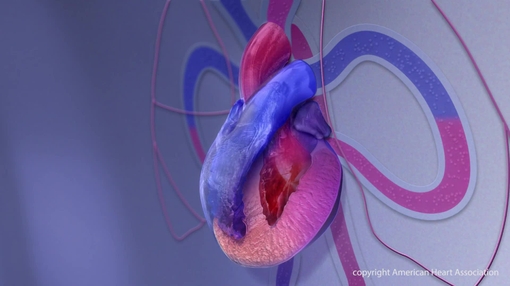 AHA / ASA Animations | American Heart Association