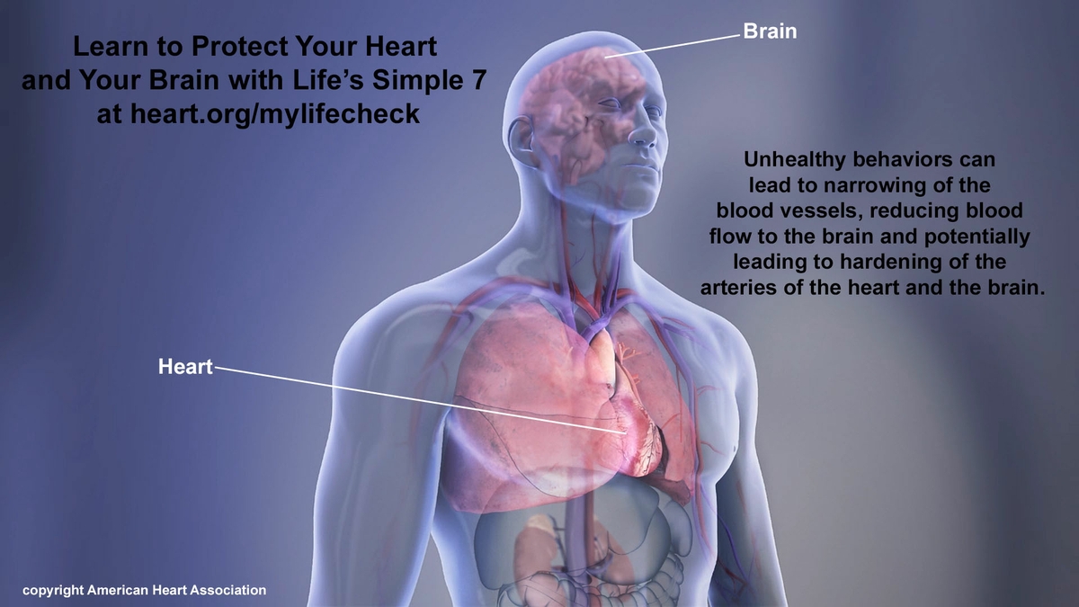 AHA/ASA Medical Graphics and Illustrations | American Heart Association