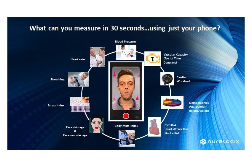 Photo | Facial blood flow data sent to the cloud | American Heart ...