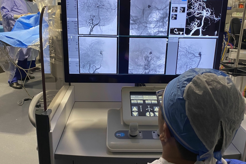 Surgeons successfully treat brain aneurysms using a robot | American ...