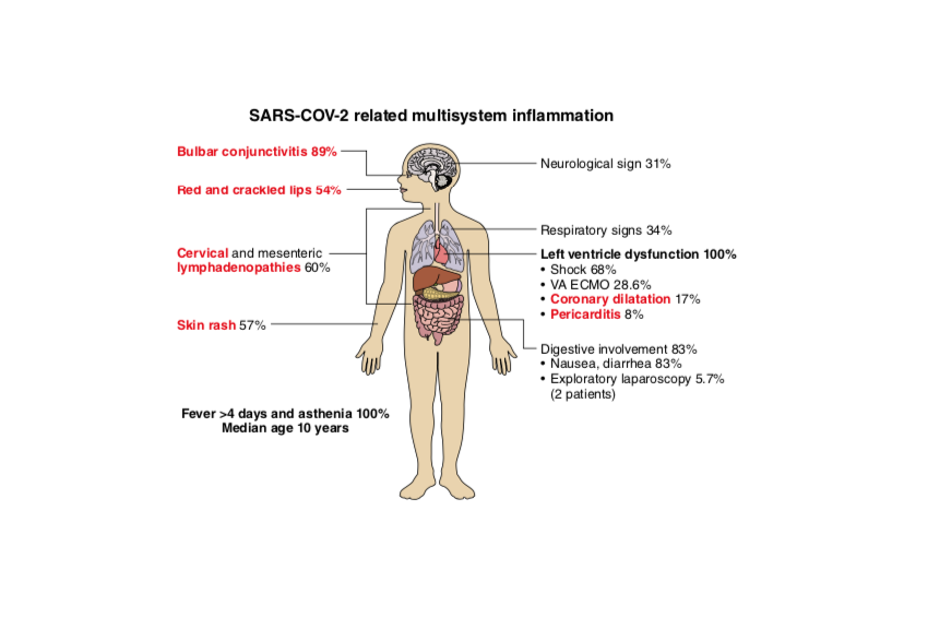 Photo | Schematic of Symptoms | American Heart Association